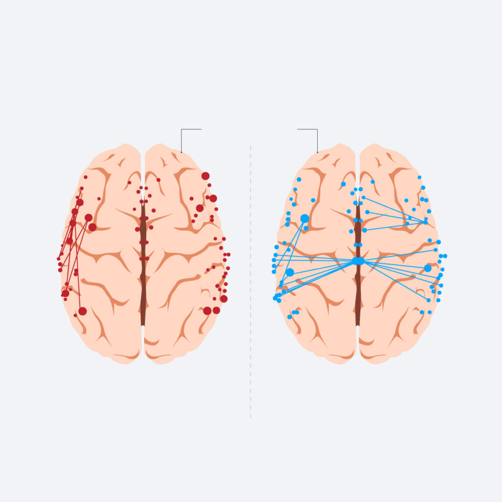 Uticaj njemačkog jezika na razvoj mozga - Njemački jezik - Glossa ...
